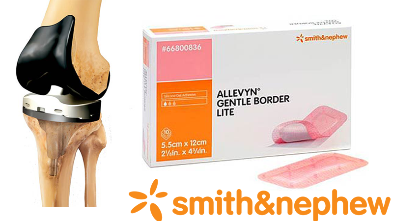 Smith & Nephew - Efficient Management and Distribution of Medical Documents